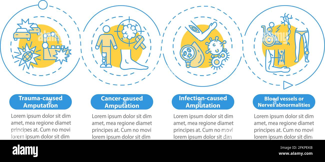 Limb removal causes vector infographic template Stock Vector Image ...