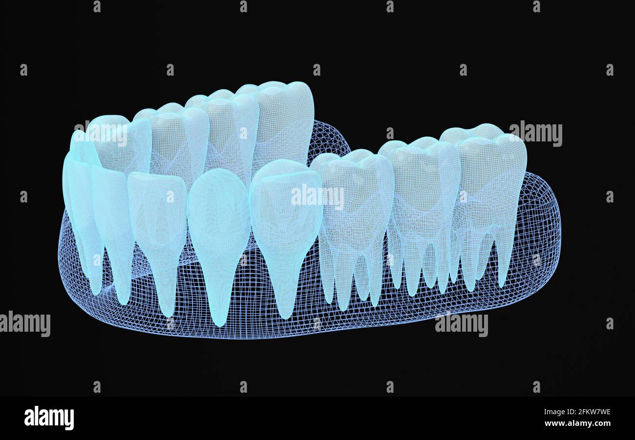 Healthy Teeth, teeth treatment, 3d rendering. Computer digital drawing ...