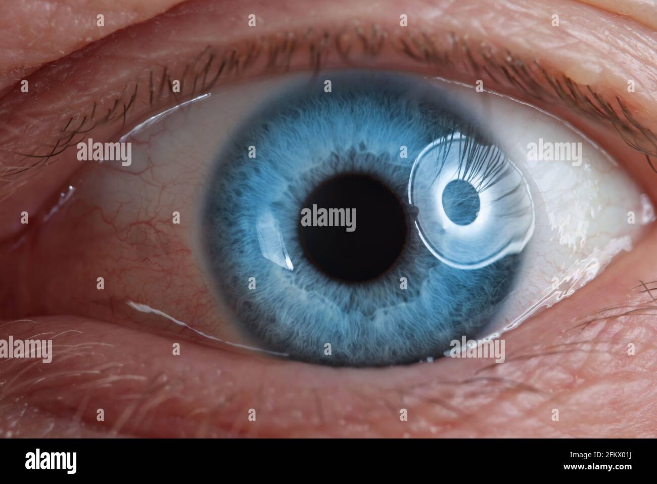 Human eye is blue. Examination of organ of vision in adults Stock Photo ...