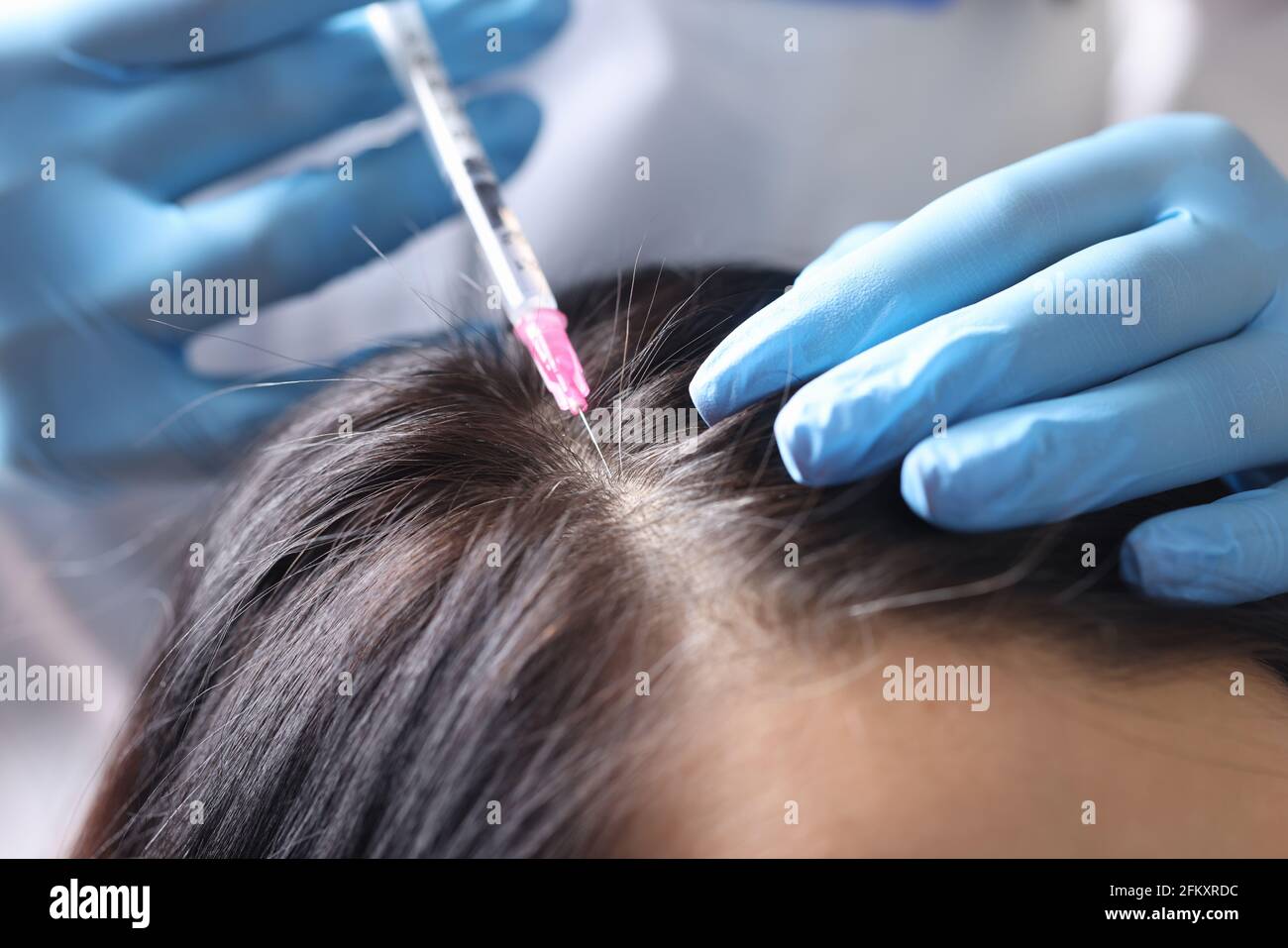 Trichologist makes an injection into scalp closeup Stock Photo - Alamy