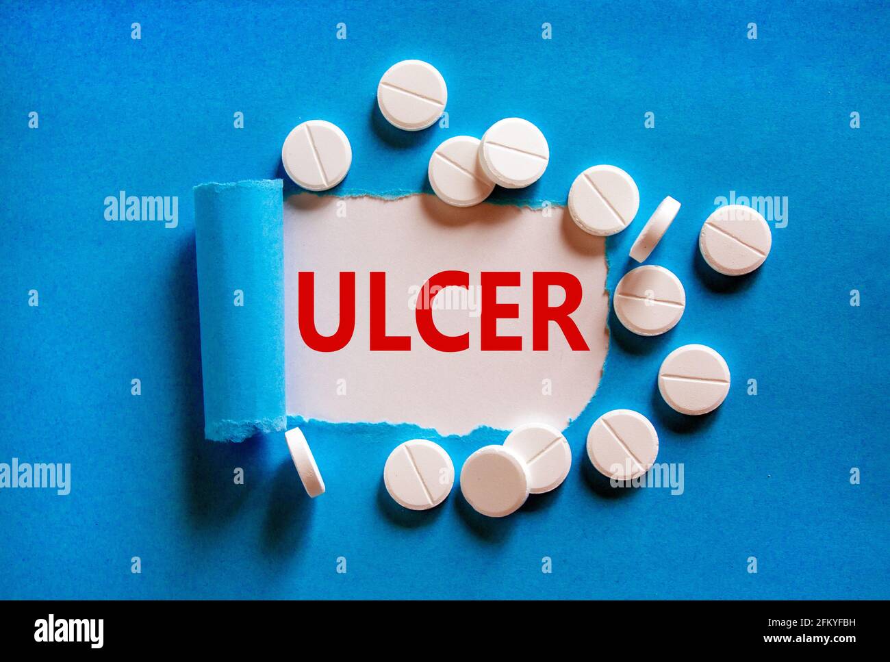 Stomach ulcer symbol. The word 'ulcer' appearing behind torn blue paper ...