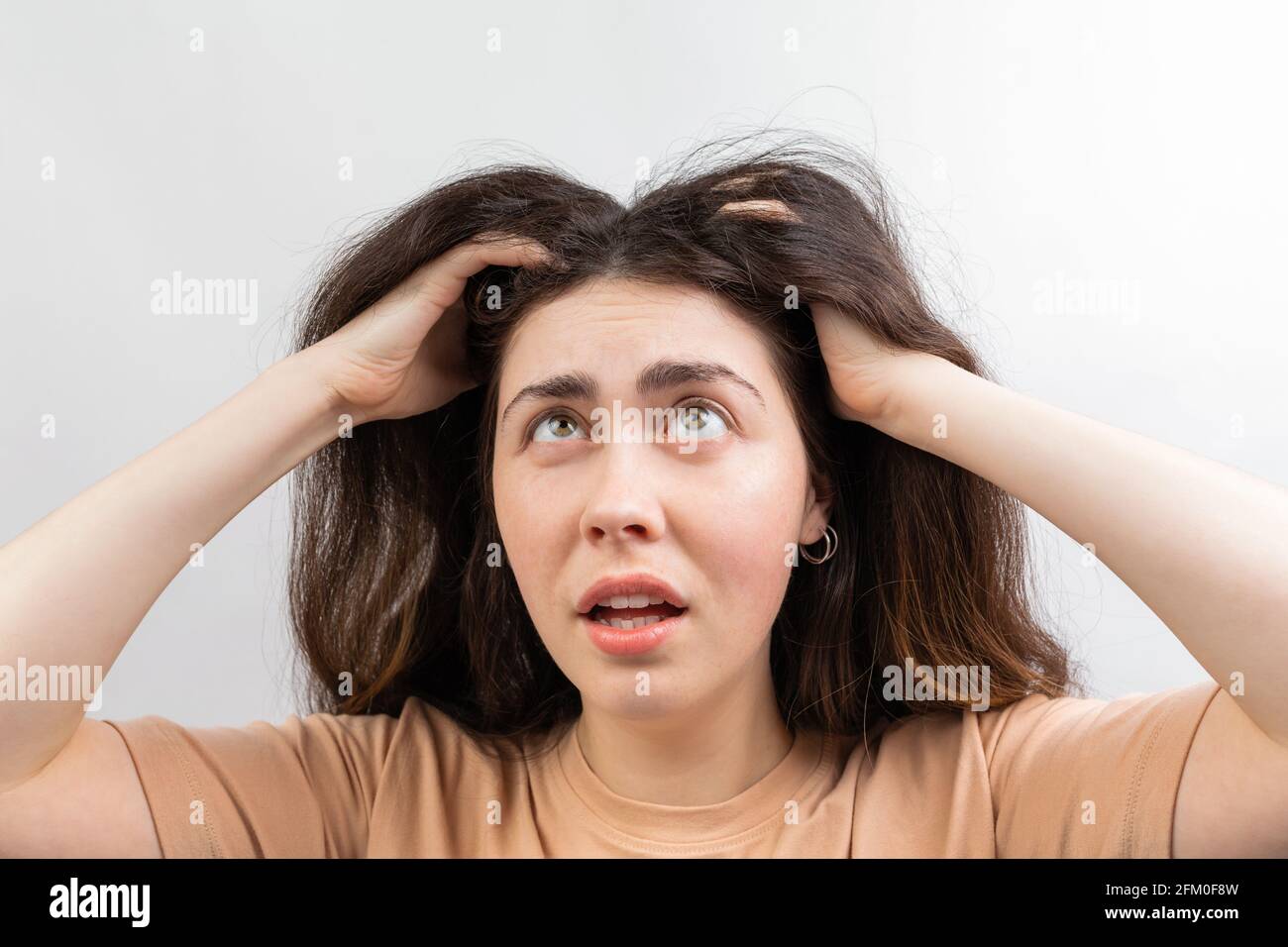 Dandruff, pediculosis and seborrhea. Portrait of a young Caucasian ...