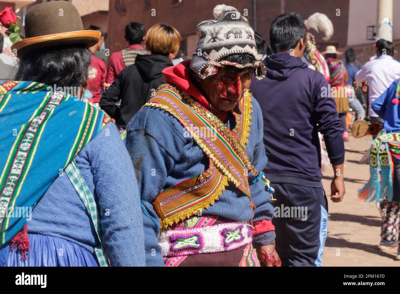 Macha, Bolivia. 04th May, 2021. A man bleeds from the nose after ...