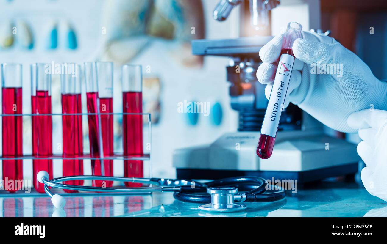 Biological scientist wear medical protective face mask looking at blood ...