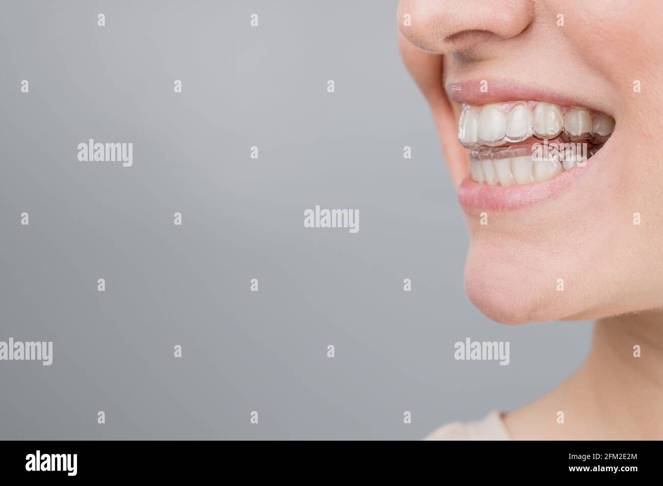 Transparent retainer hi-res stock photography and images - Alamy