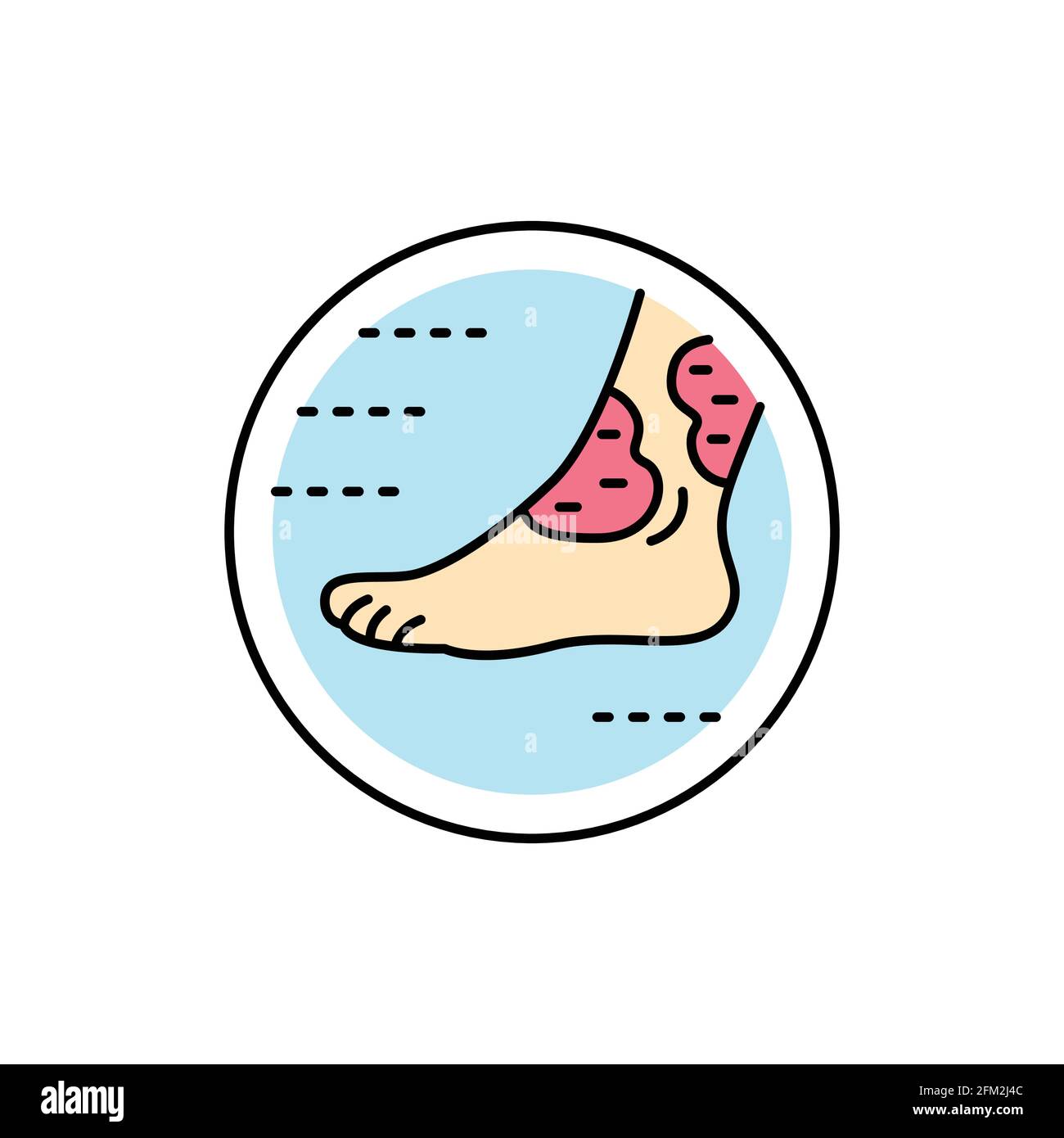 Atopic Dermatitis Color Line Icon Dermatology Disease Isolated Vector