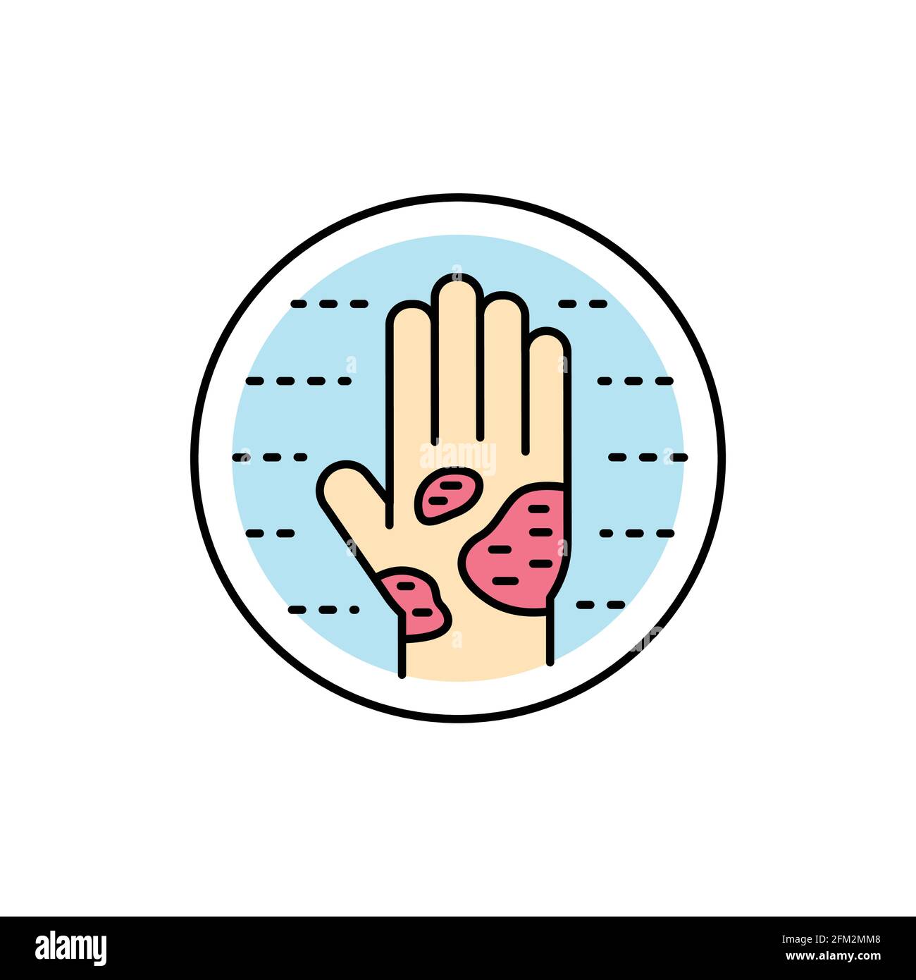 Eczema vector vectors hi-res stock photography and images - Alamy