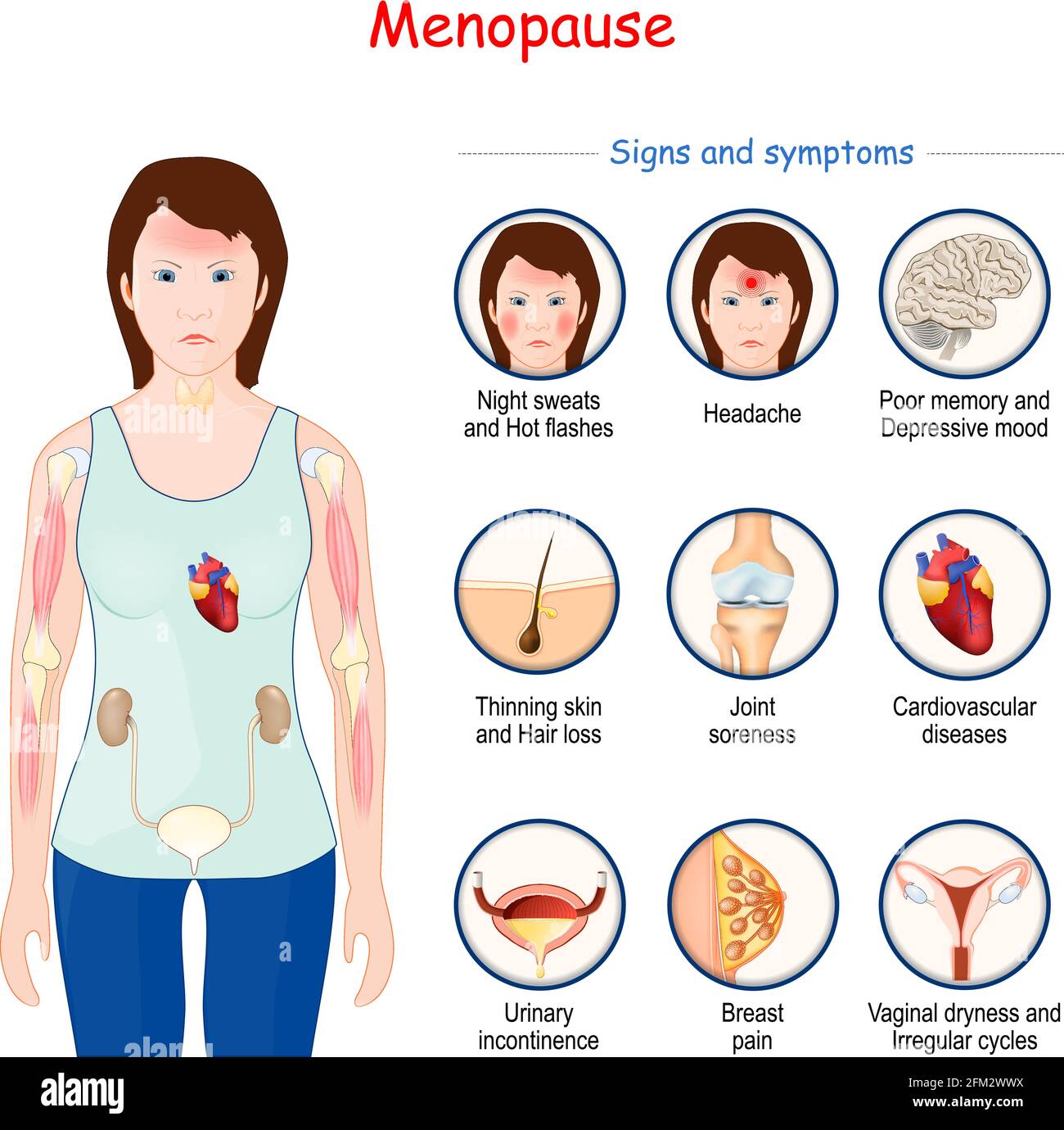 Menopause. climacteric Signs and symptoms. Vector Illustration with ...