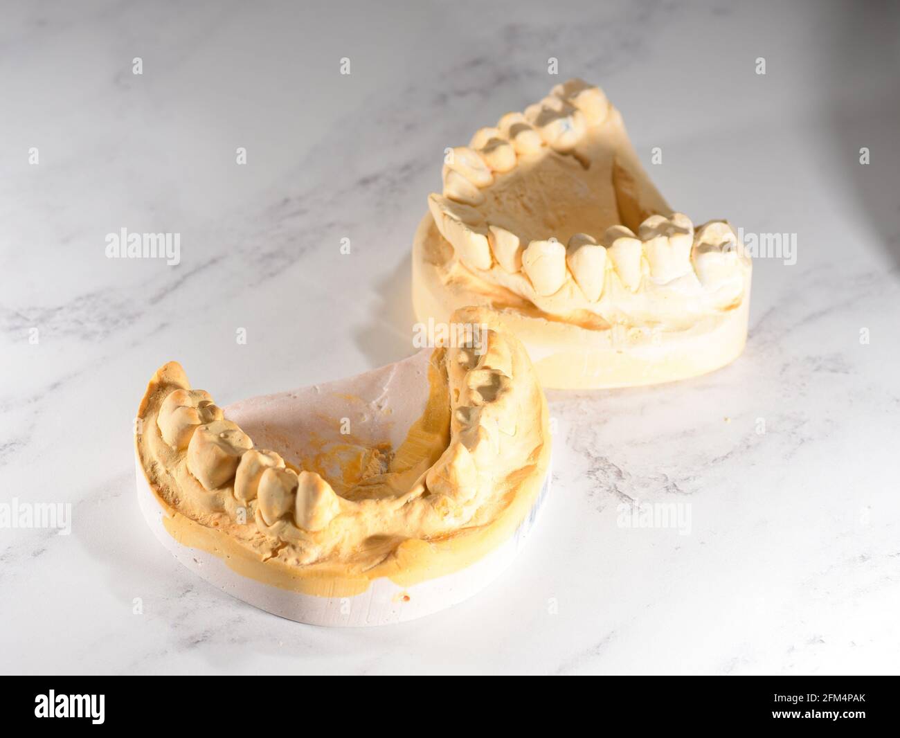 Plaster moulds for making False teeth - dentures impressions Stock ...