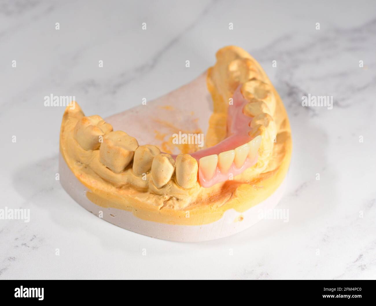 Plaster moulds for making False teeth with false teeth in place Stock ...