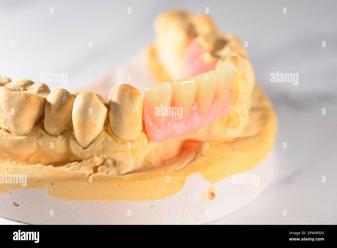 Plaster moulds for making False teeth with false teeth in place Stock ...