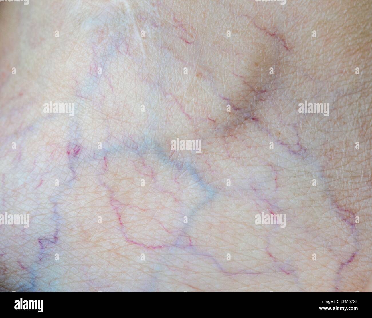 Veins Arm Woman High Resolution Stock Photography and Images - Alamy