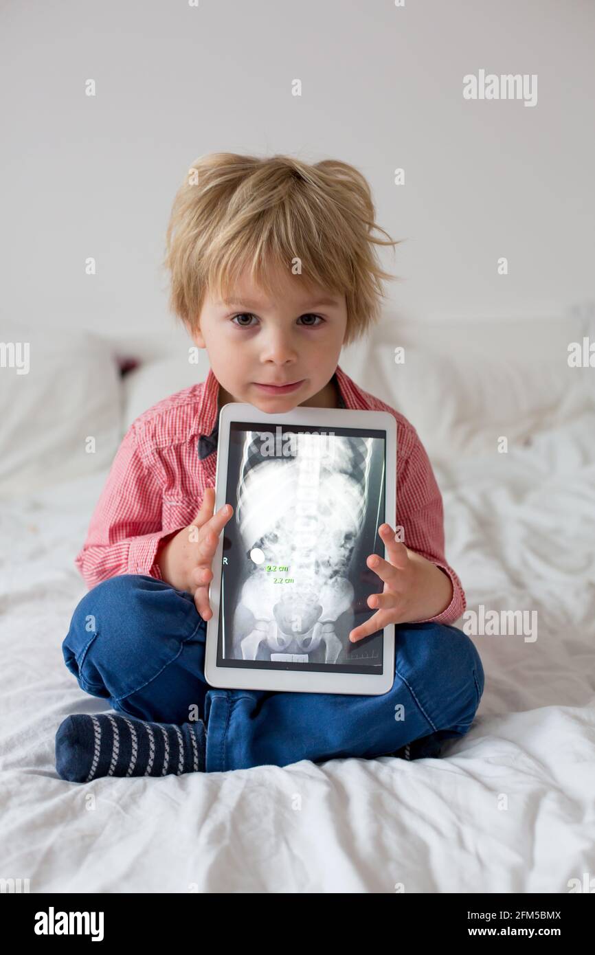 Toddler child, blond boy, holding x-ray picture on tablet of child body ...