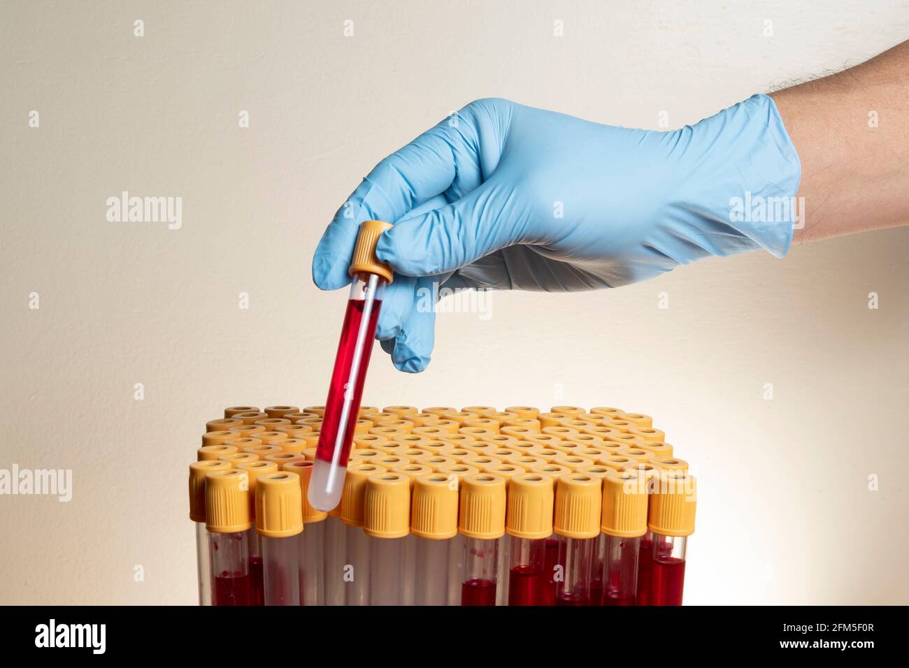 hand with protective nitrile glove holding tube to collect blood sample ...