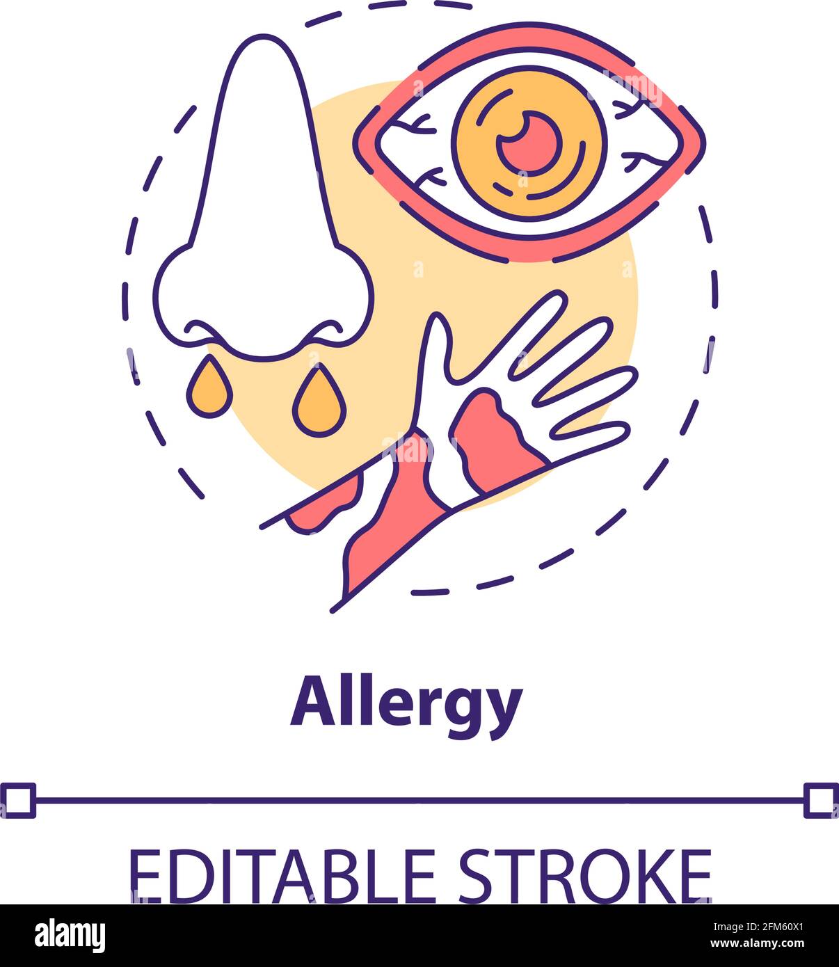 Allergic Rhinitis Poster
