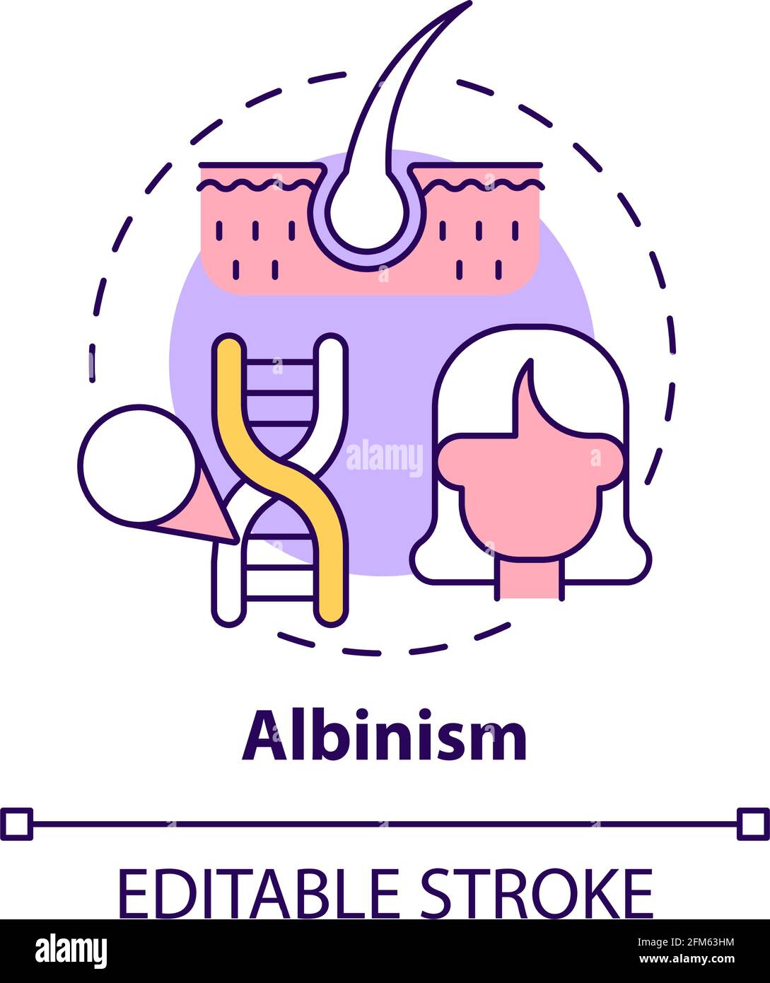 Albinism Genetic Mutation