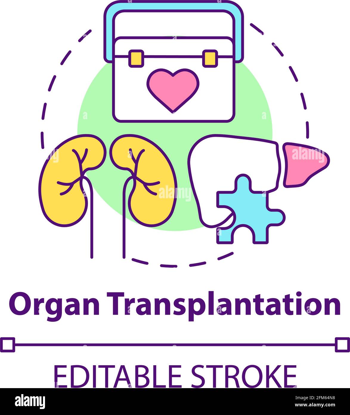 Transplantation of kidney Stock Vector Images - Alamy