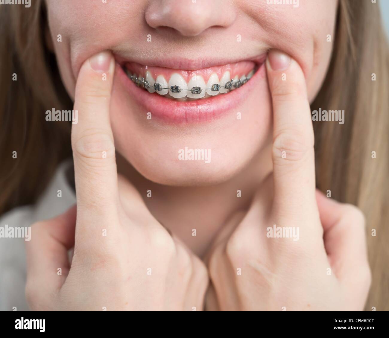 Girl braces tongue hi-res stock photography and images - Alamy