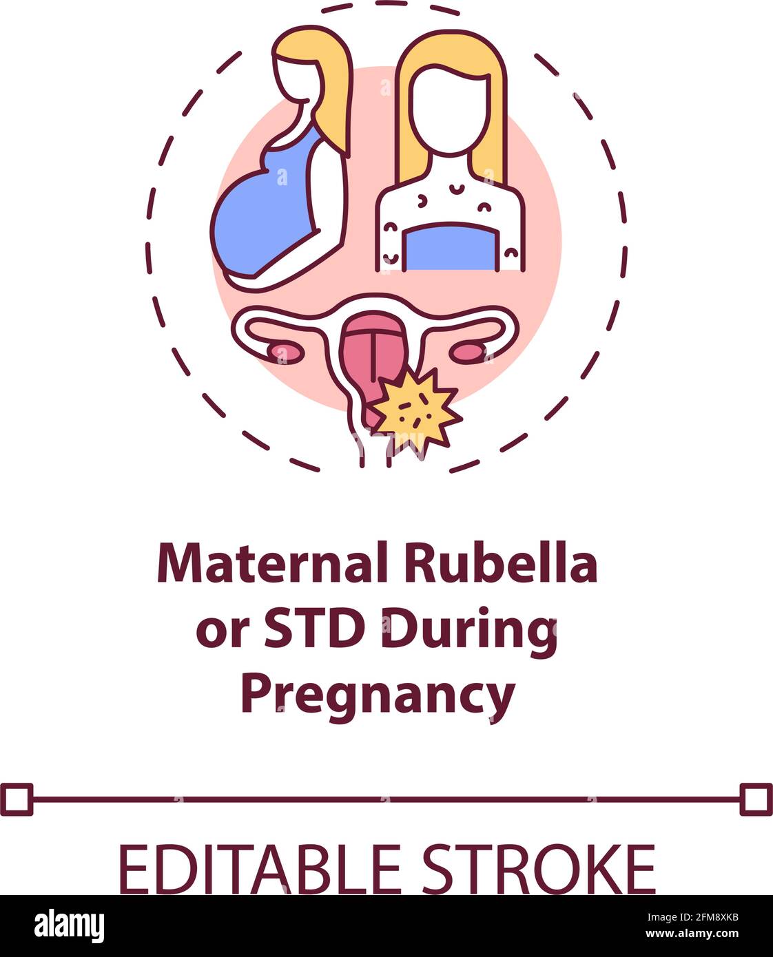 Congenital rubella hi-res stock photography and images - Alamy