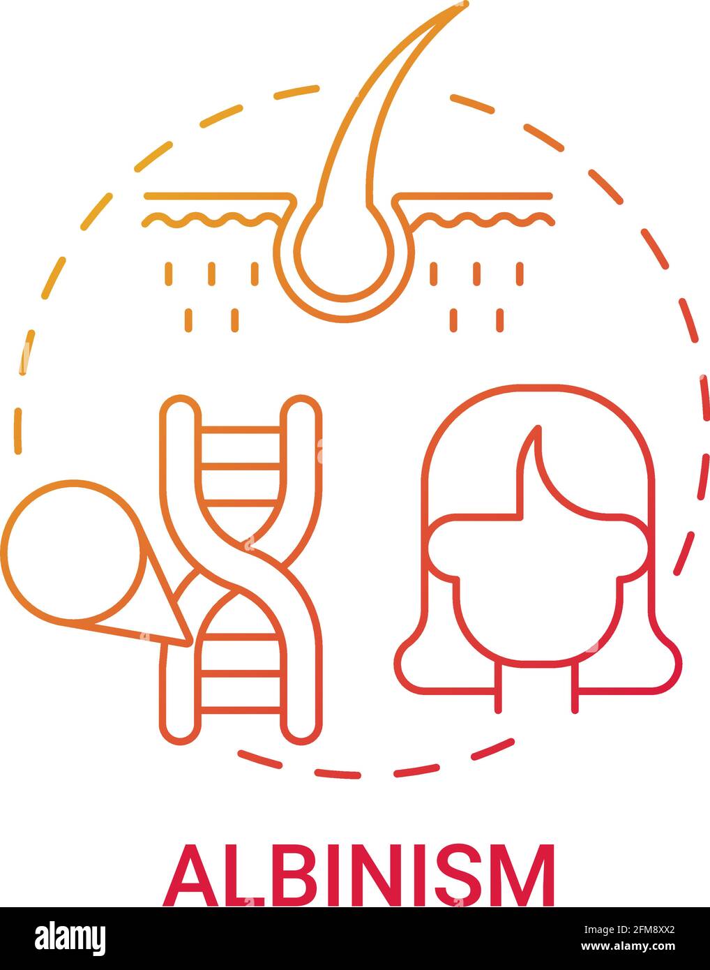 Albinism Stock Vector Images - Alamy