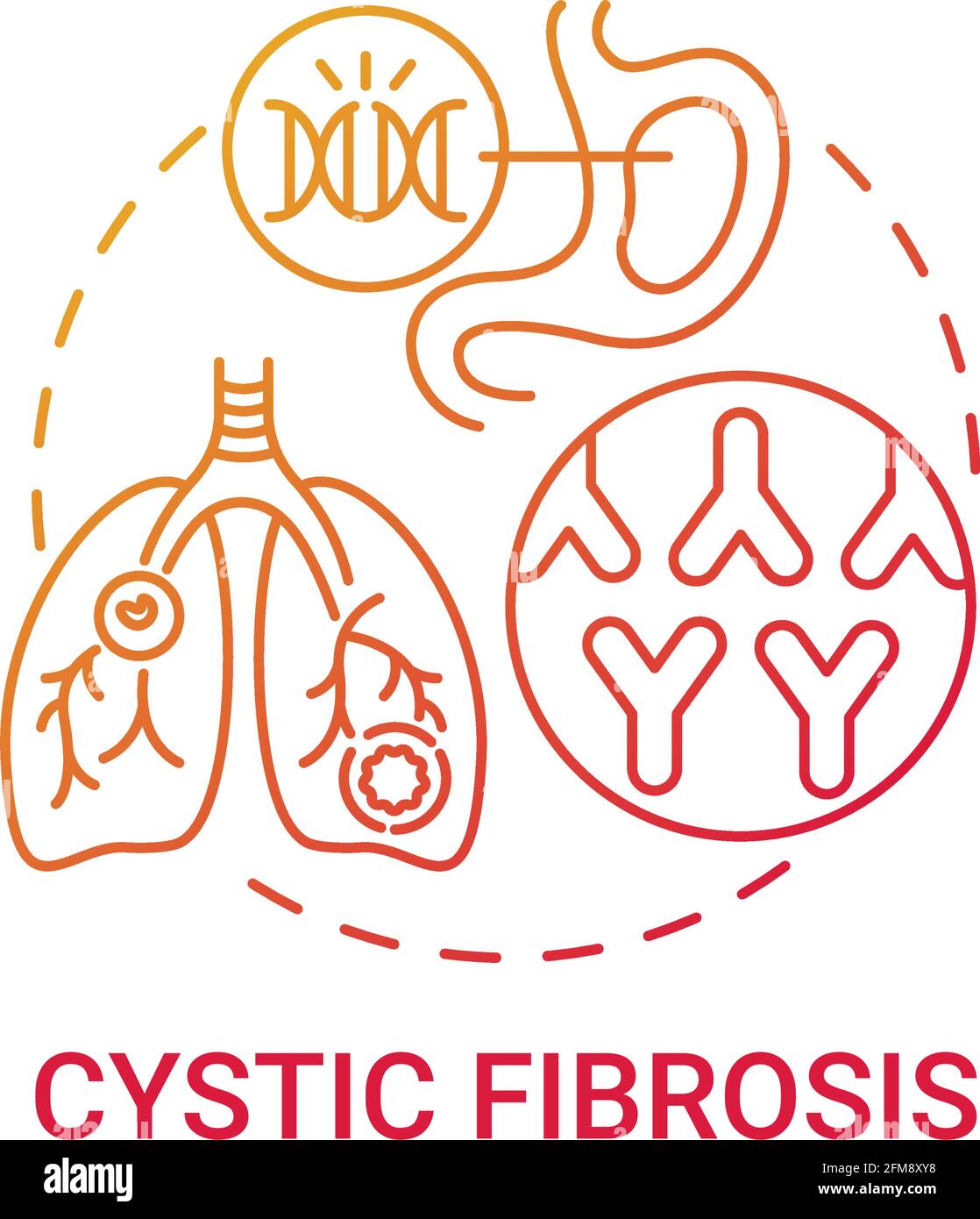 Cystic Fibrosis Red Gradient Concept Icon Stock Vector Image And Art Alamy