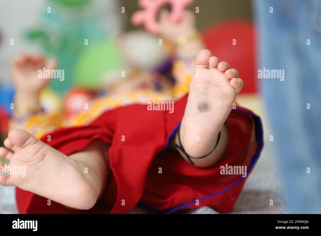 Birthmark child hi-res stock photography and images - Alamy