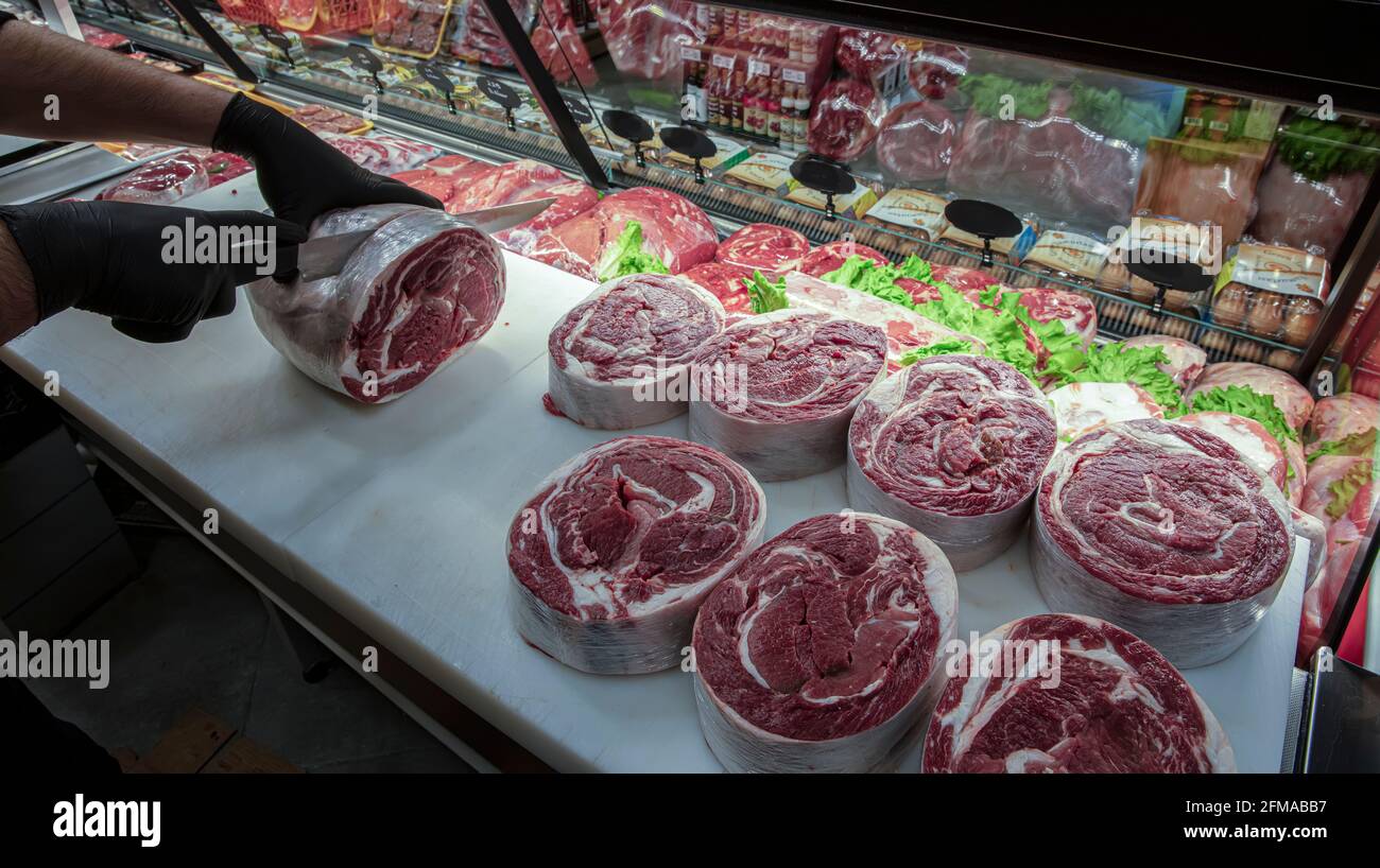 Fat injection hi-res stock photography and images - Alamy