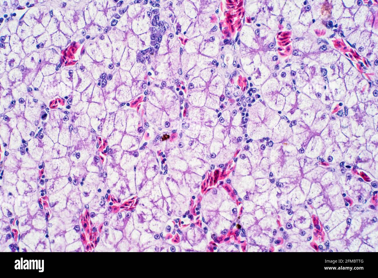 Human liver tissue, light micrograph Stock Photo - Alamy