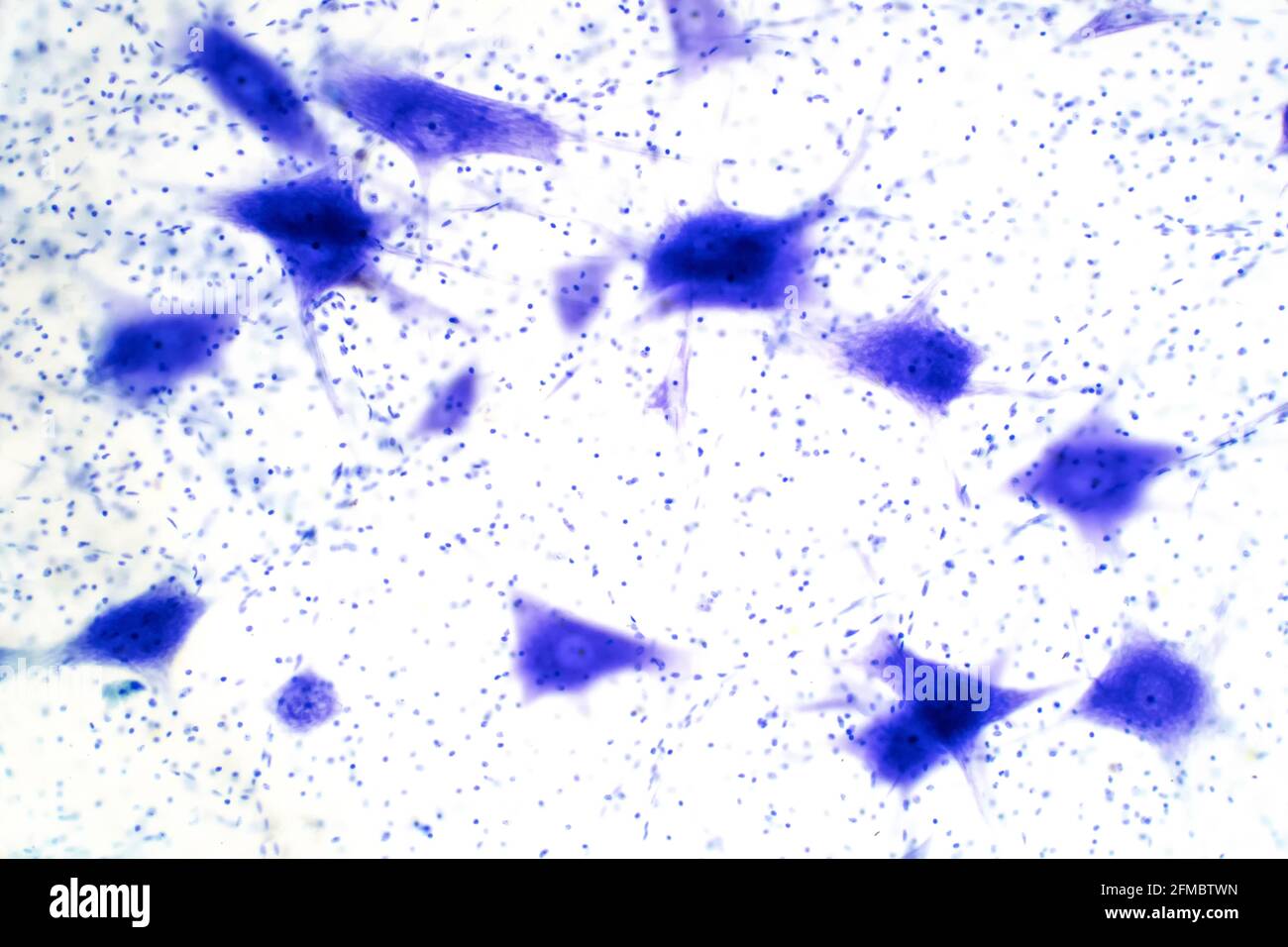 Nerve cells, light micrograph Stock Photo - Alamy