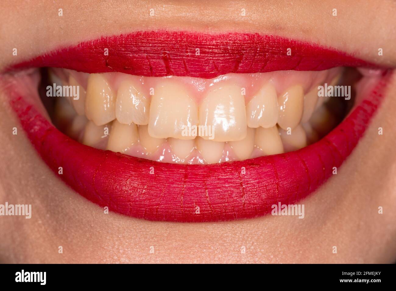 Closeup of a female's mouth with beautiful set of teeth Stock Photo - Alamy