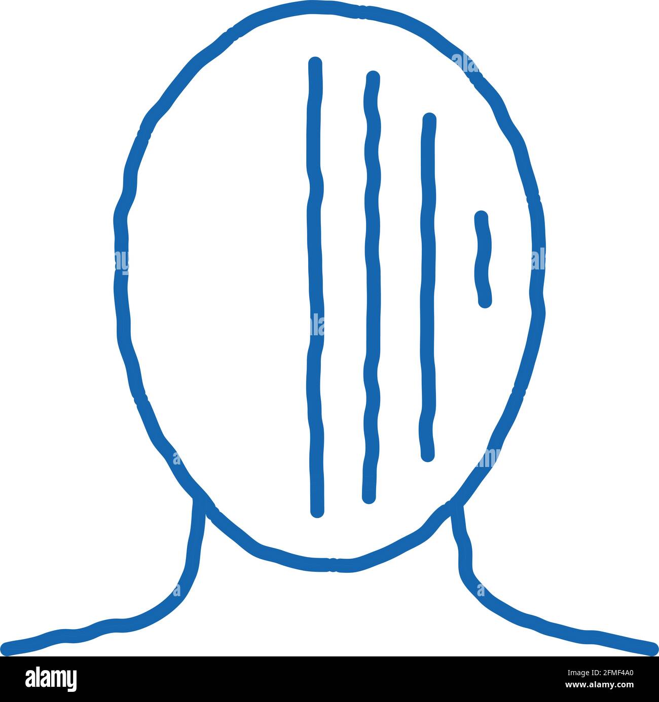 Migraine Nausea And Visual Changes Head Vector Stock Vector Image & Art ...