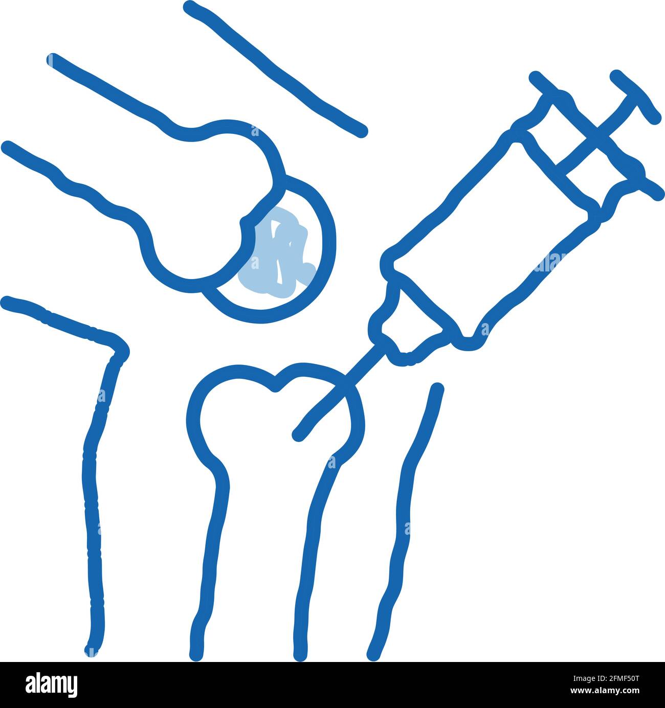 Syringe Injection Vaccine In Bone doodle icon hand drawn illustration ...