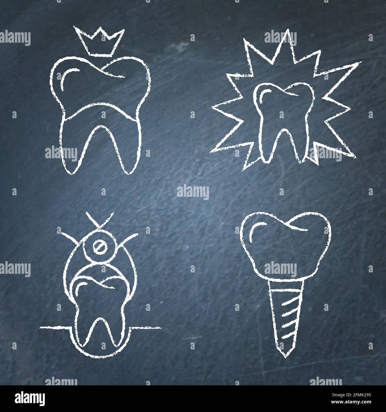 Stomatological procedures icon set on chalkboard. Dental treatment ...