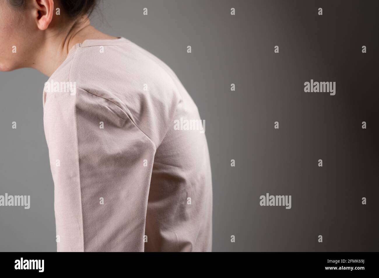 The woman has a stooped posture Stock Photo - Alamy