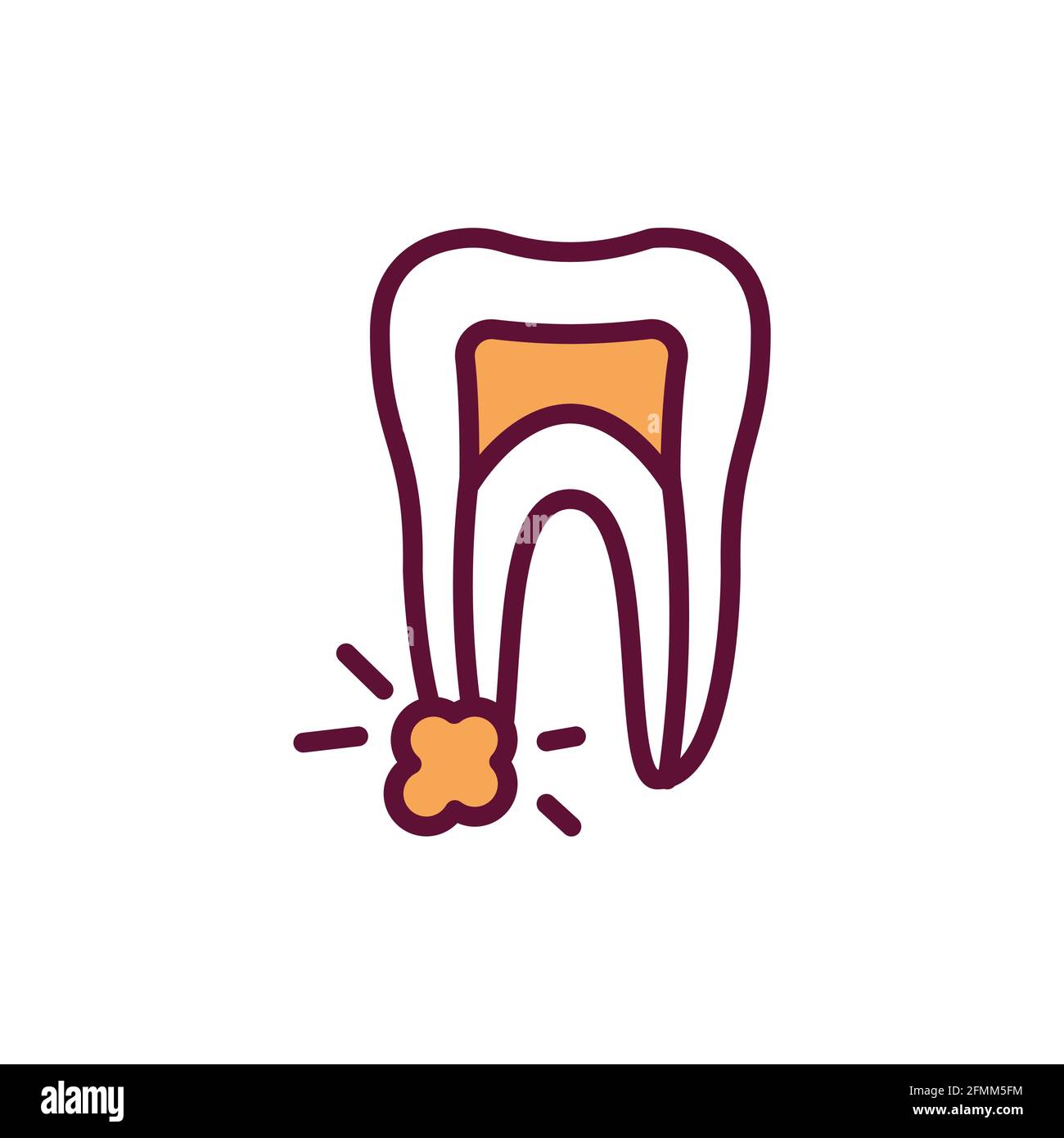 Cyst Of Tooth High Resolution Stock Photography and Images - Alamy