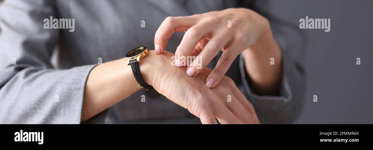 Woman scratches her hand with her nails Stock Photo - Alamy