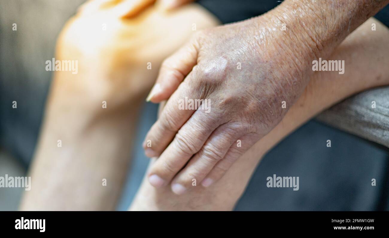 Close-up of the wrinkled hands of an elderly man. The hand swollen ...