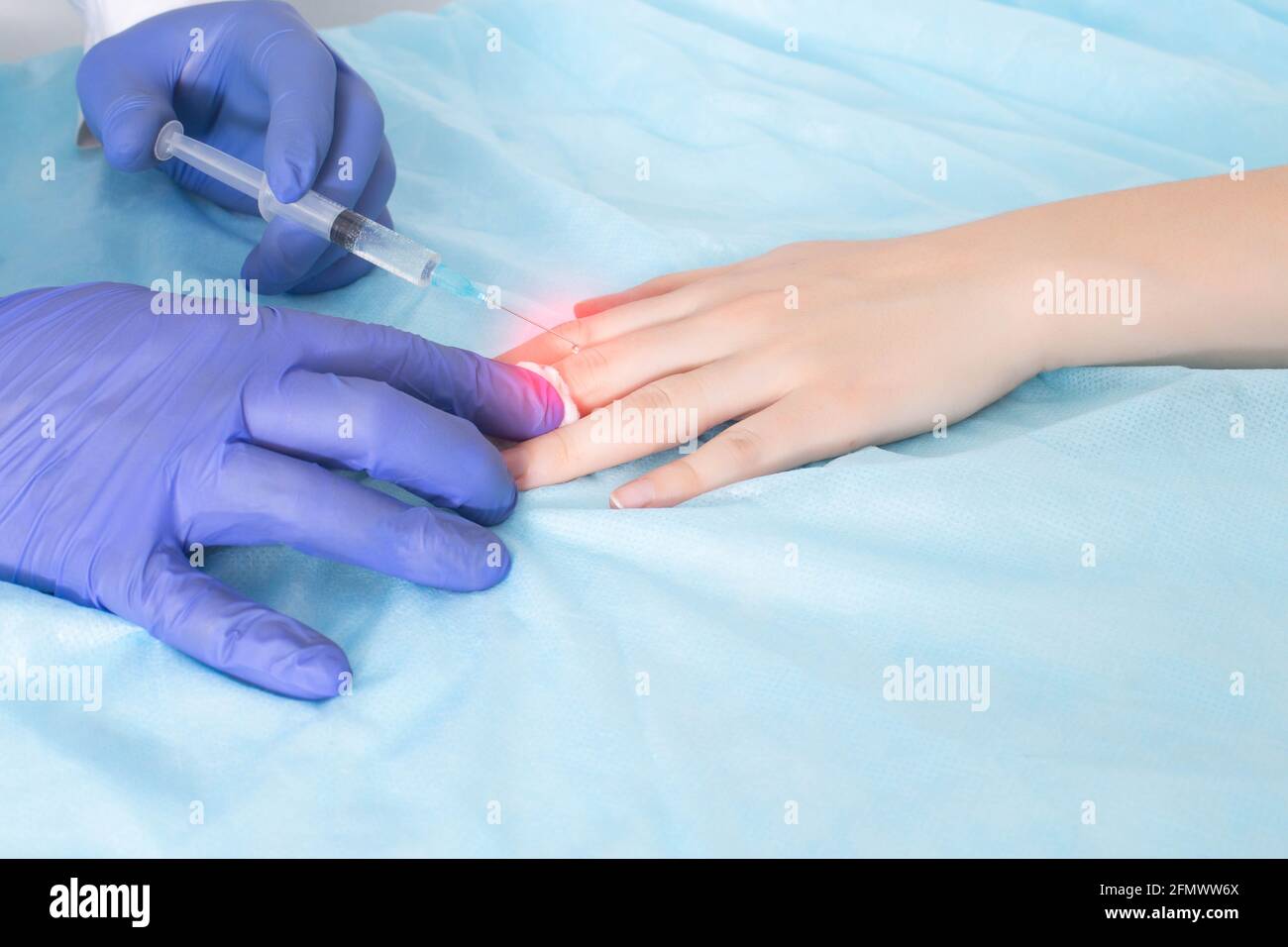 The doctor makes an injection in the joint of the finger on the hand ...
