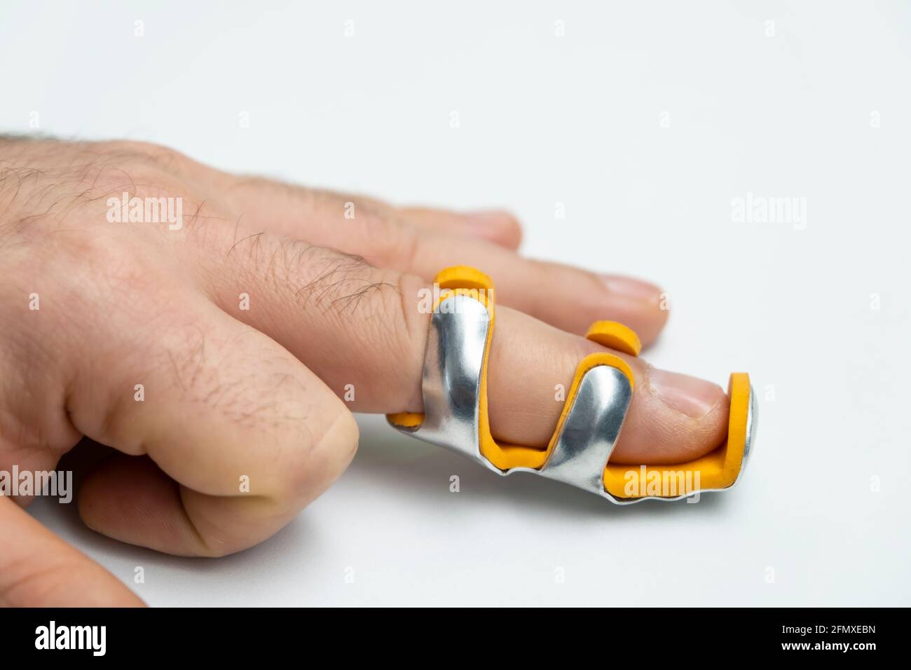 Broken Finger Splint Or Cast