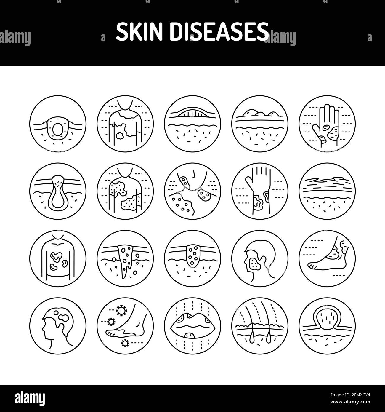 Nodular Acne Stock Vector Images Alamy