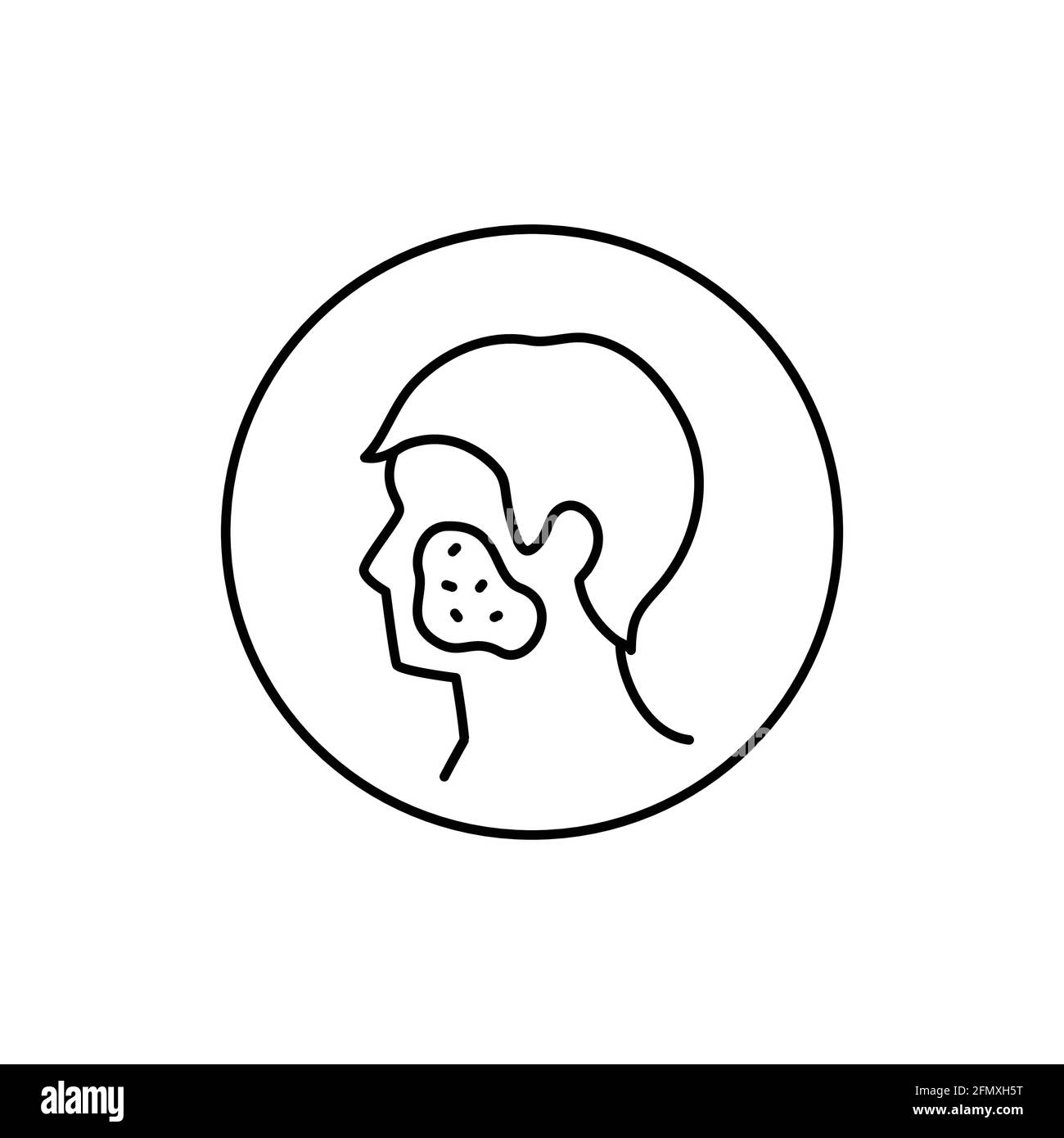 Rosacea Black Line Icon Dermatology Disease Isolated Vector Element