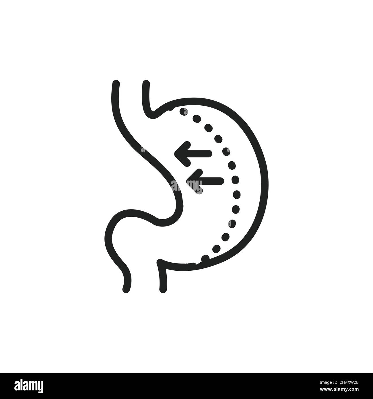 Gastrectomy illustration Stock Vector Images - Alamy