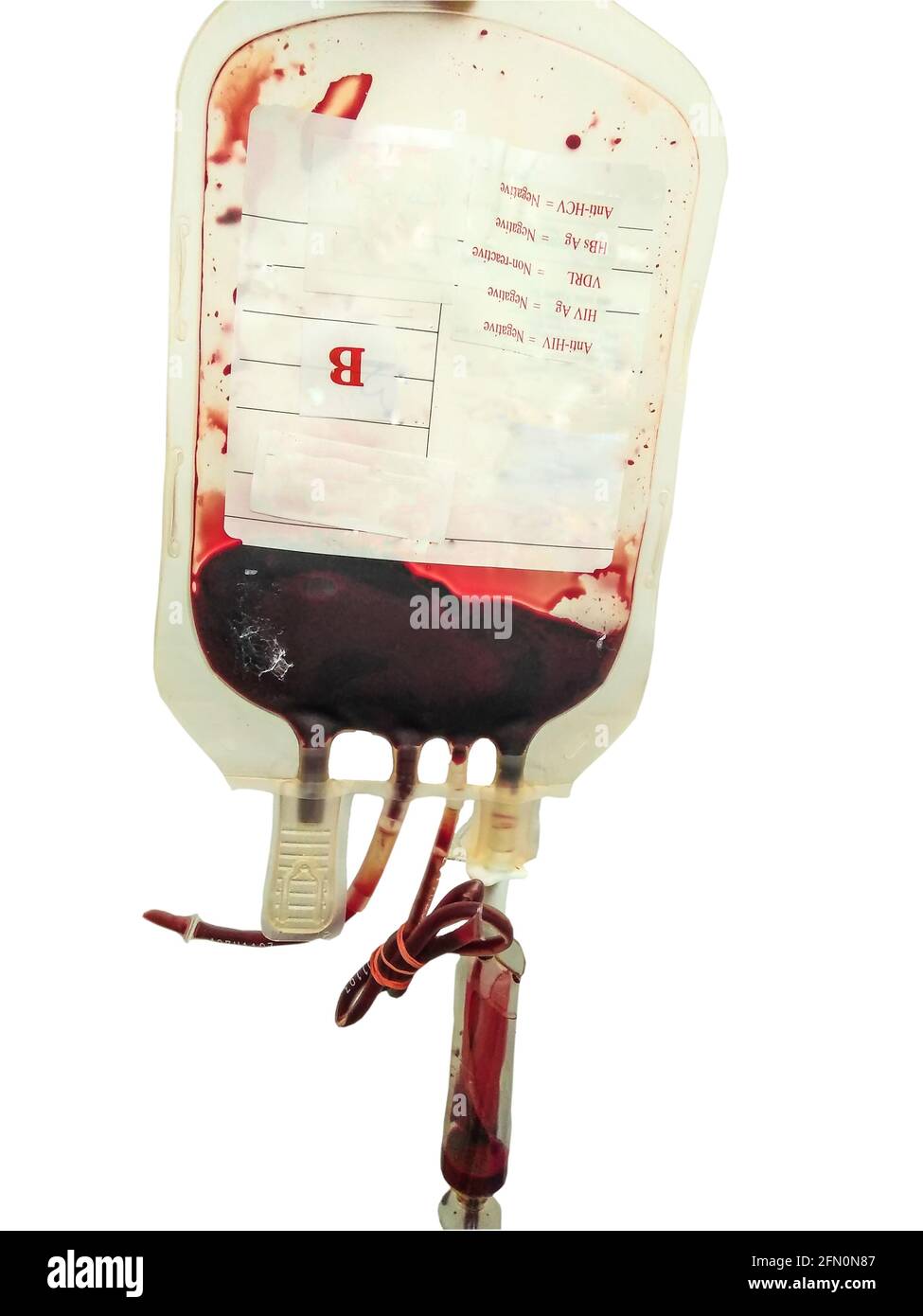 Empty blood bag isolated on white background.Saved with clipping path ...