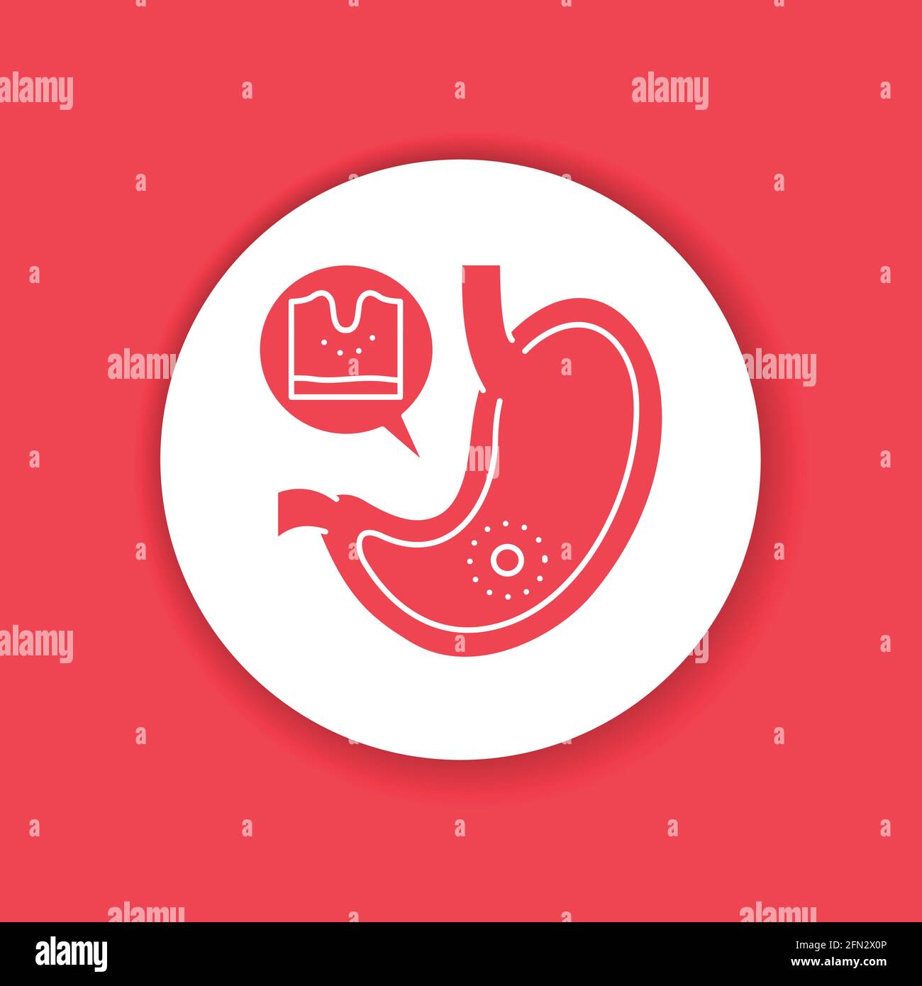 Chronic And Acute Gastritis High Resolution Stock Photography and ...