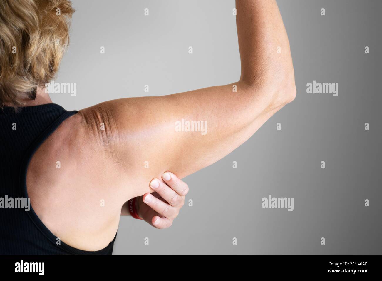 Older Woman Cosmetic Liposuction Surgery And Body Fat Check Stock Photo ...