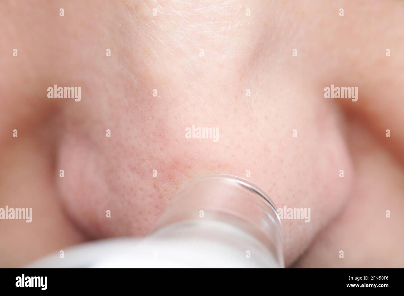 Cosmetology with tool theme. Deep cleaning skin from blackheads in ...