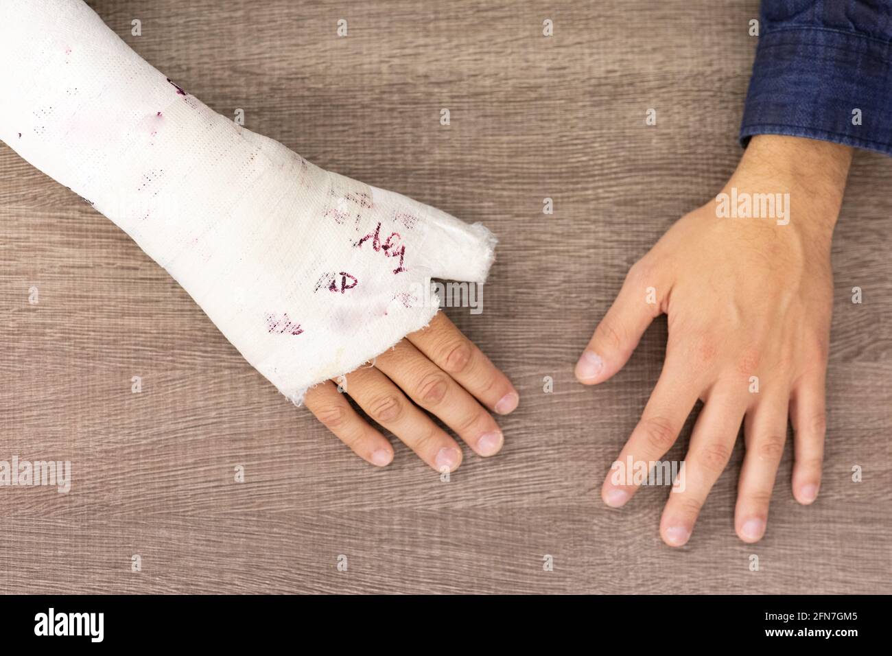 Body parts plaster hi-res stock photography and images - Alamy