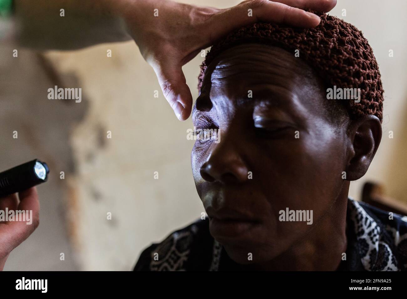 Foreign doctor is examining the yellow eyes of a patient in a medical ...