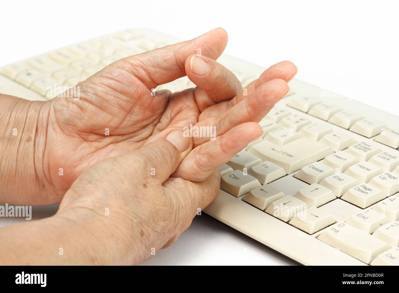 Painful finger joints hi-res stock photography and images - Alamy