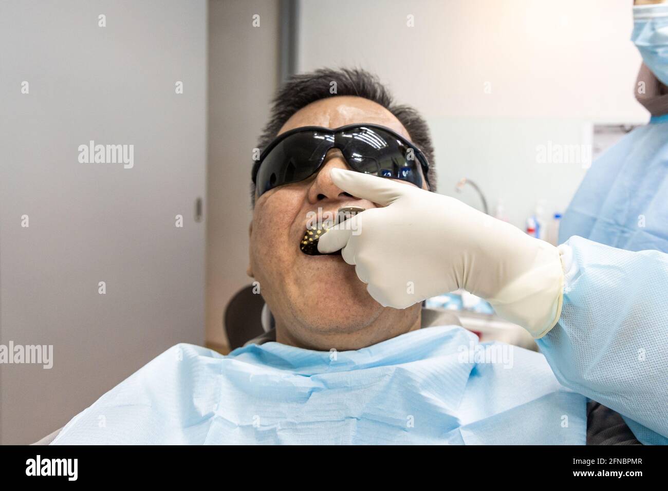 Dental impression hi-res stock photography and images - Alamy